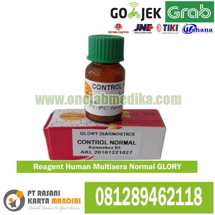 Jual Reagent Human Multisera Normal GLORY – Serum Kontrol Laboratorium